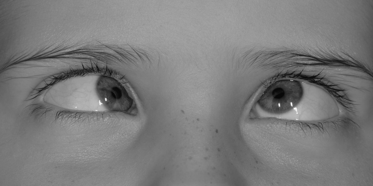 Você sabe como o estrabismo é causado?